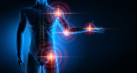 Was ist eine Spondylarthrose? - Ursachen, Symptome, Behandlung » Krank.de