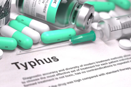 Was ist Typhus? - Ursachen, Symptome, Behandlung » Krank.de
