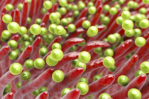 Was ist eine Phlegmone? - Ursachen, Symptome, Behandlung » Krank.de