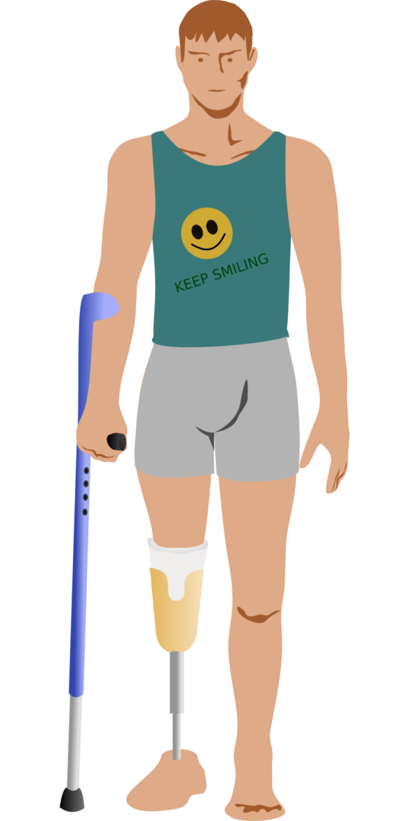 Amputation erklärt! Wirkung, Durchführung & Anwendung, Ursprung ...