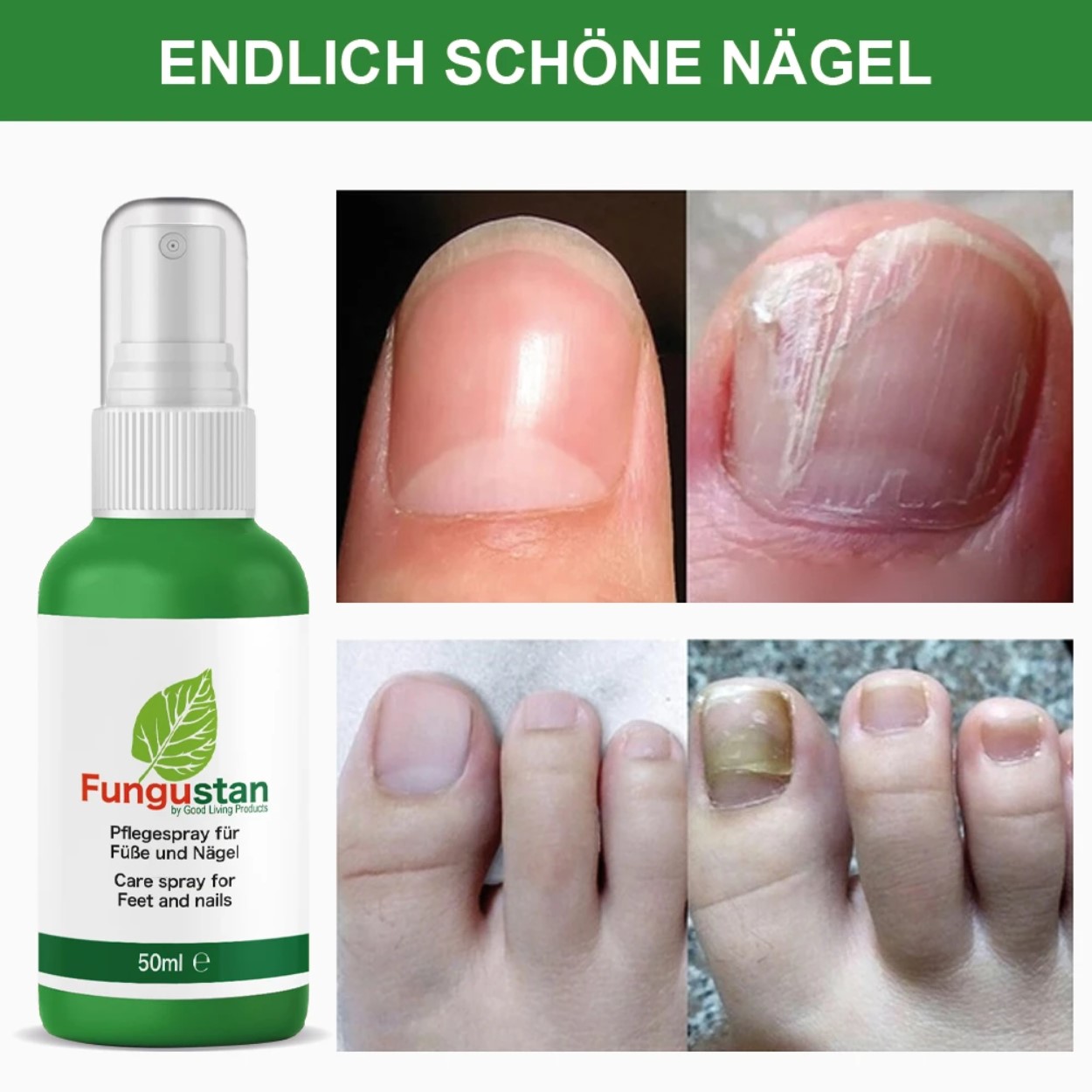 Fungustan Produktcheck - Bewertung - Produkt im Test » Krank.de