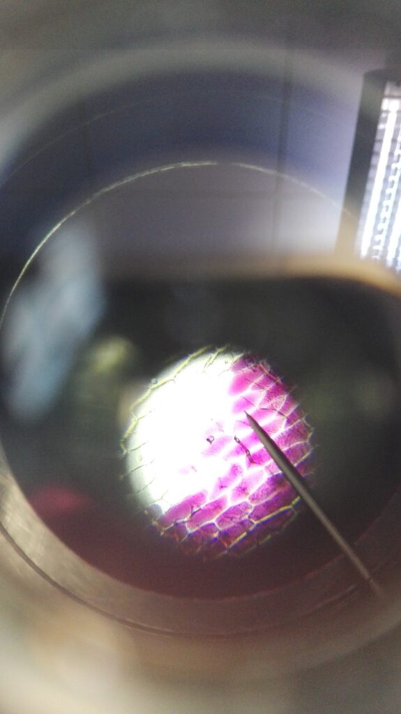 Abstrich erklärt! Funktion, Durchführung, Anwendung & Risiken » Krank.de