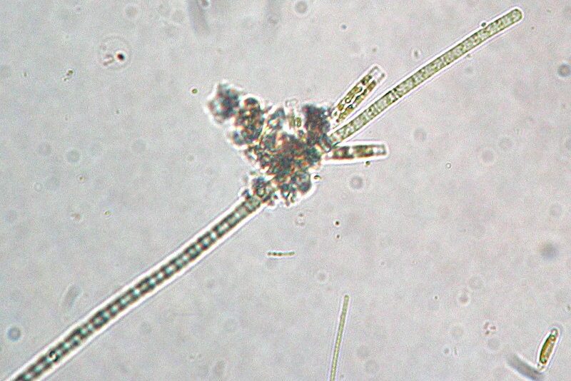 AFA-Alge (Grüne Spanalge) » Anwendung & Risiken » Krank.de